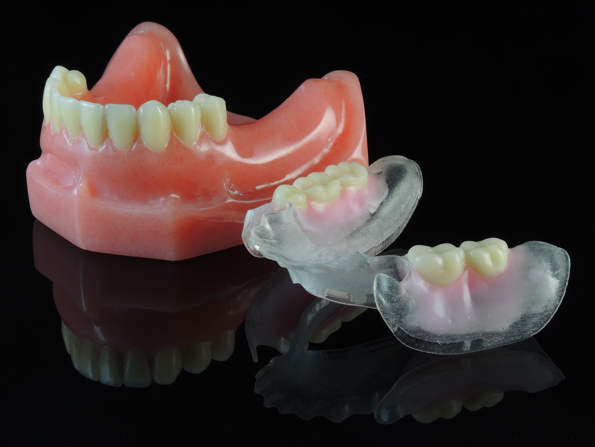 Removable Partial Dentures - Easy Bite Denture
